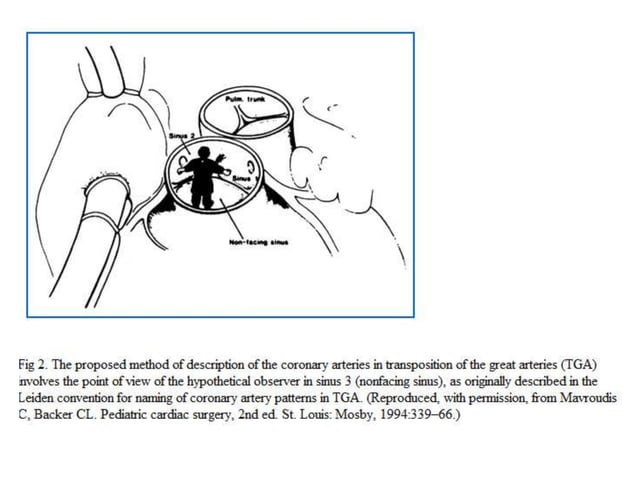 Classification of chd | PPTX