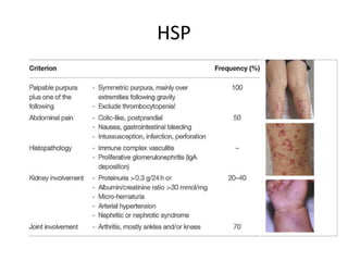 Classification of childhood vasculitis | PPT