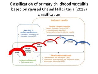 Classification of childhood vasculitis | PPT