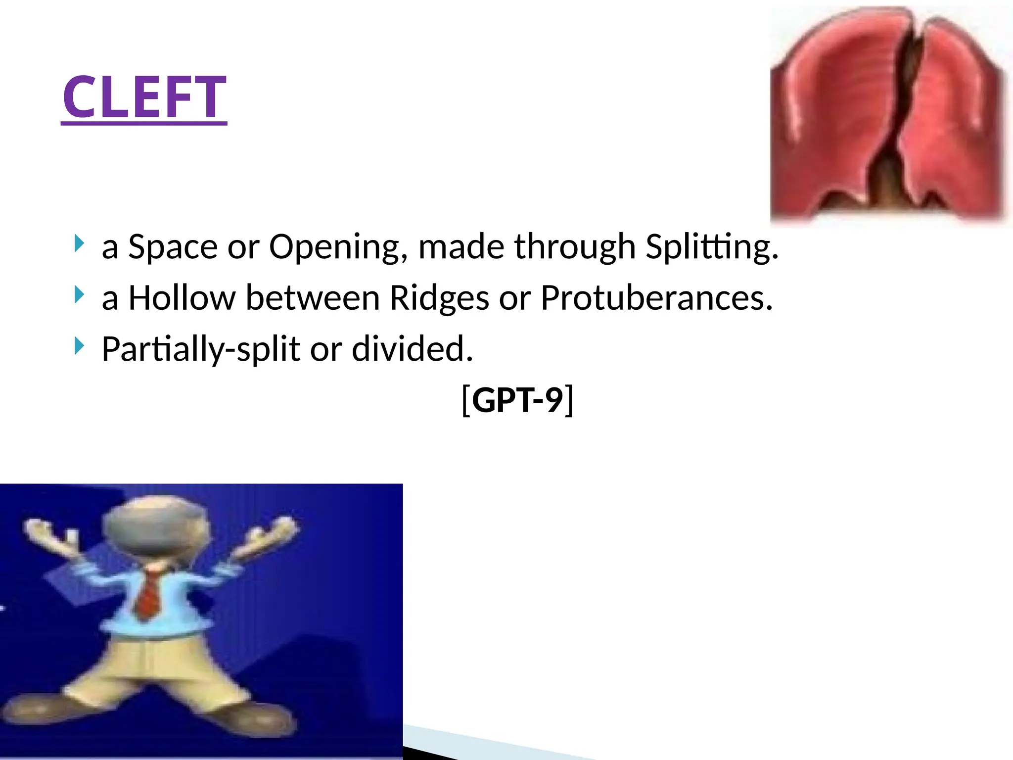 CLASSIFICATION OF CLEFT LIP & CLEFT PALATE, AND THEIR PROSTHODONTIC ...