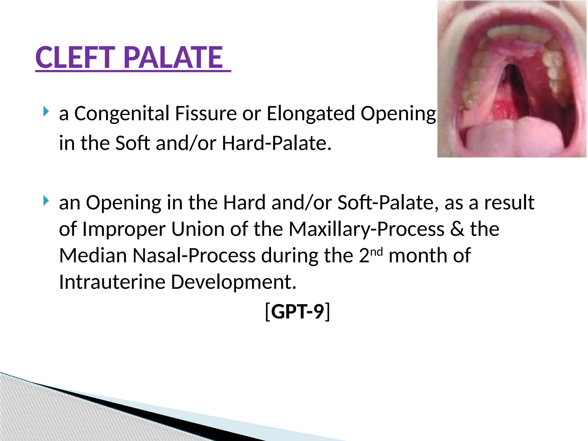 CLASSIFICATION OF CLEFT LIP & CLEFT PALATE, AND THEIR PROSTHODONTIC ...
