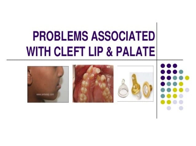 CLASSIFICATION OF CLEFT LIP & CLEFT PALATE, AND THEIR PROSTHODONTIC ...