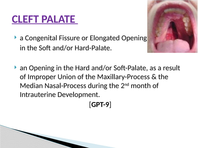 CLASSIFICATION OF CLEFT LIP & CLEFT PALATE, AND THEIR PROSTHODONTIC ...