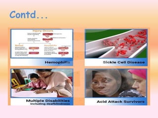 Classification of CWSN.pptx