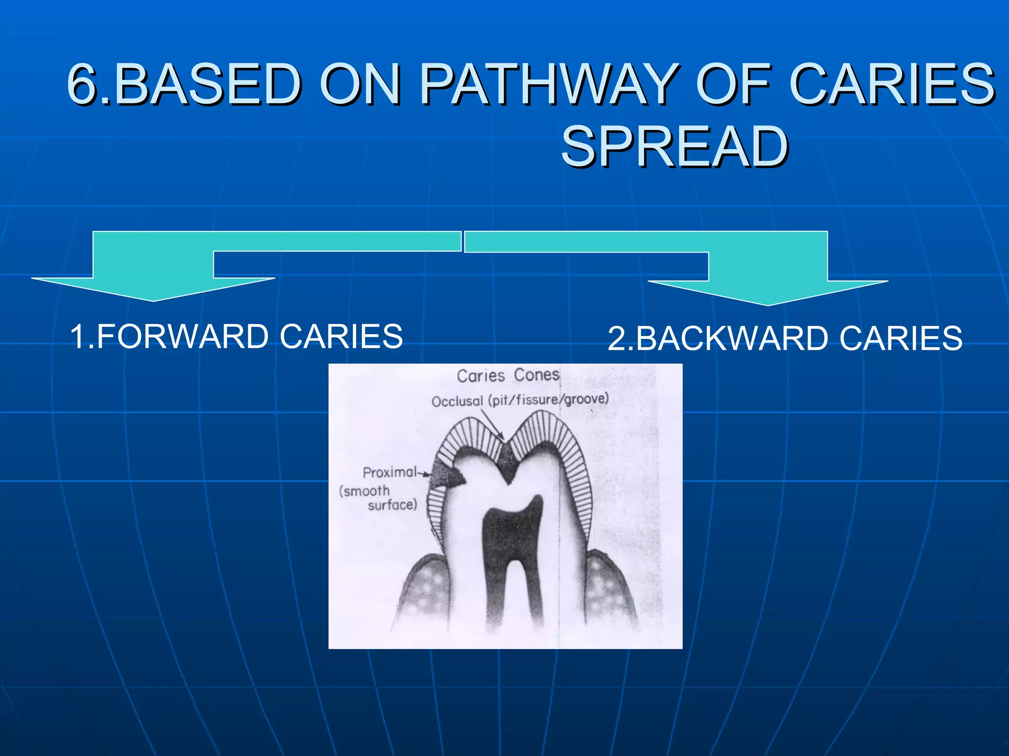 Classification Of Dental Caries | PPT