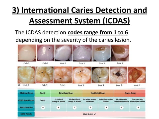 Classification of dental caries rasha adel copy | PPTX
