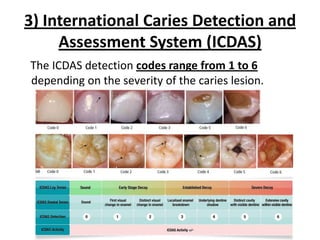 Classification of dental caries rasha adel copy