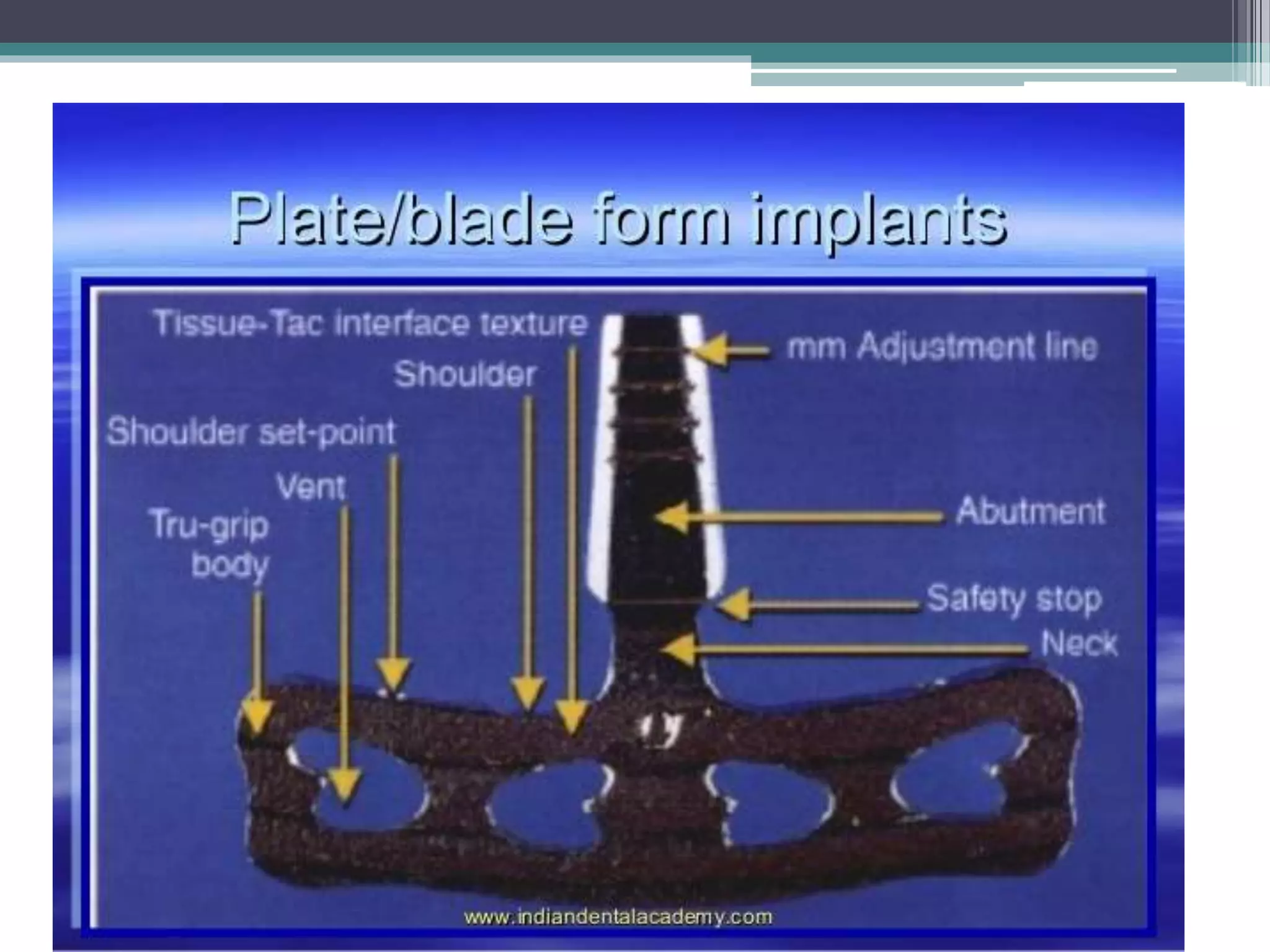 Classification of dental implant | PPTX