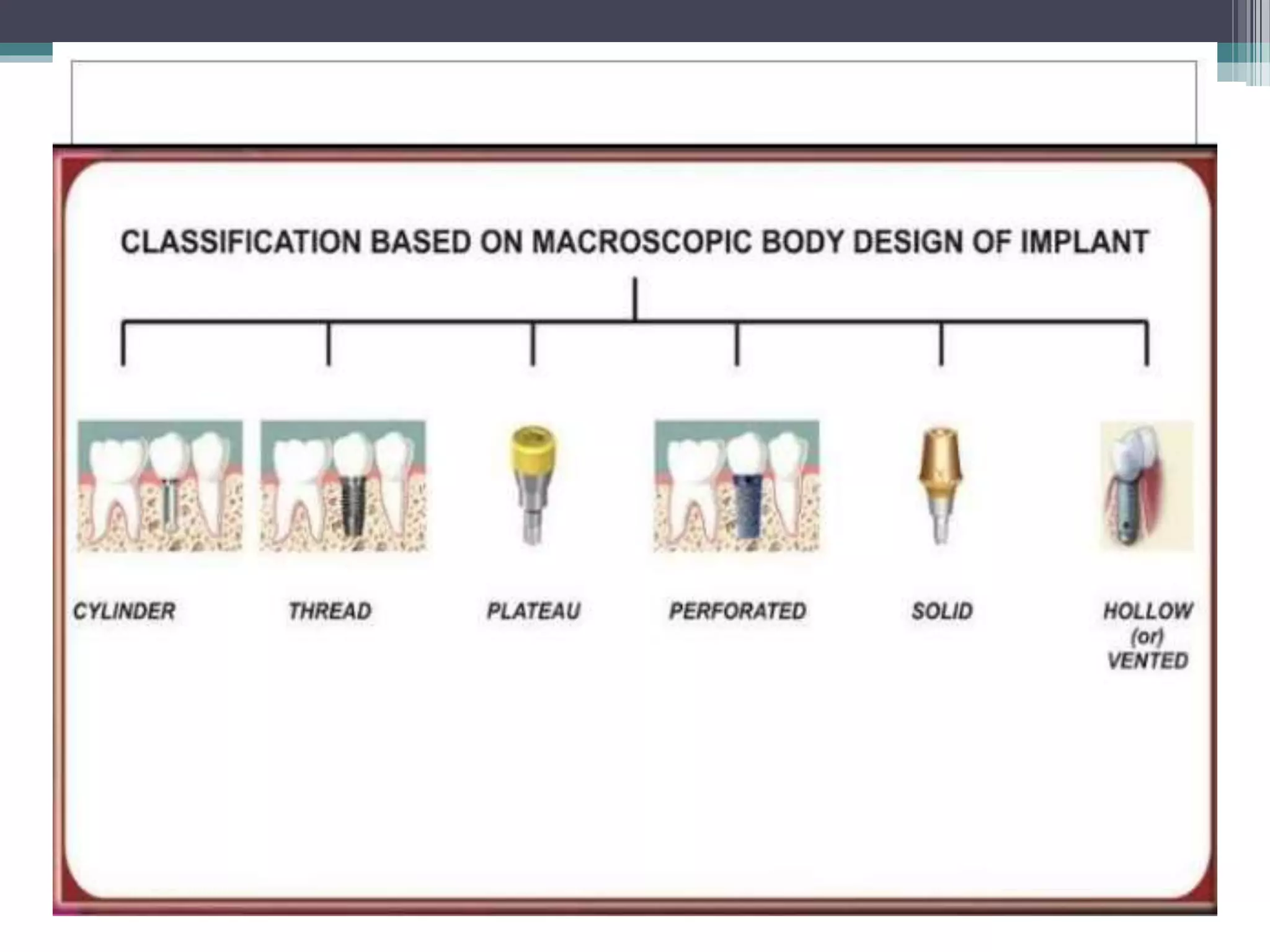 Classification of dental implant | PPTX