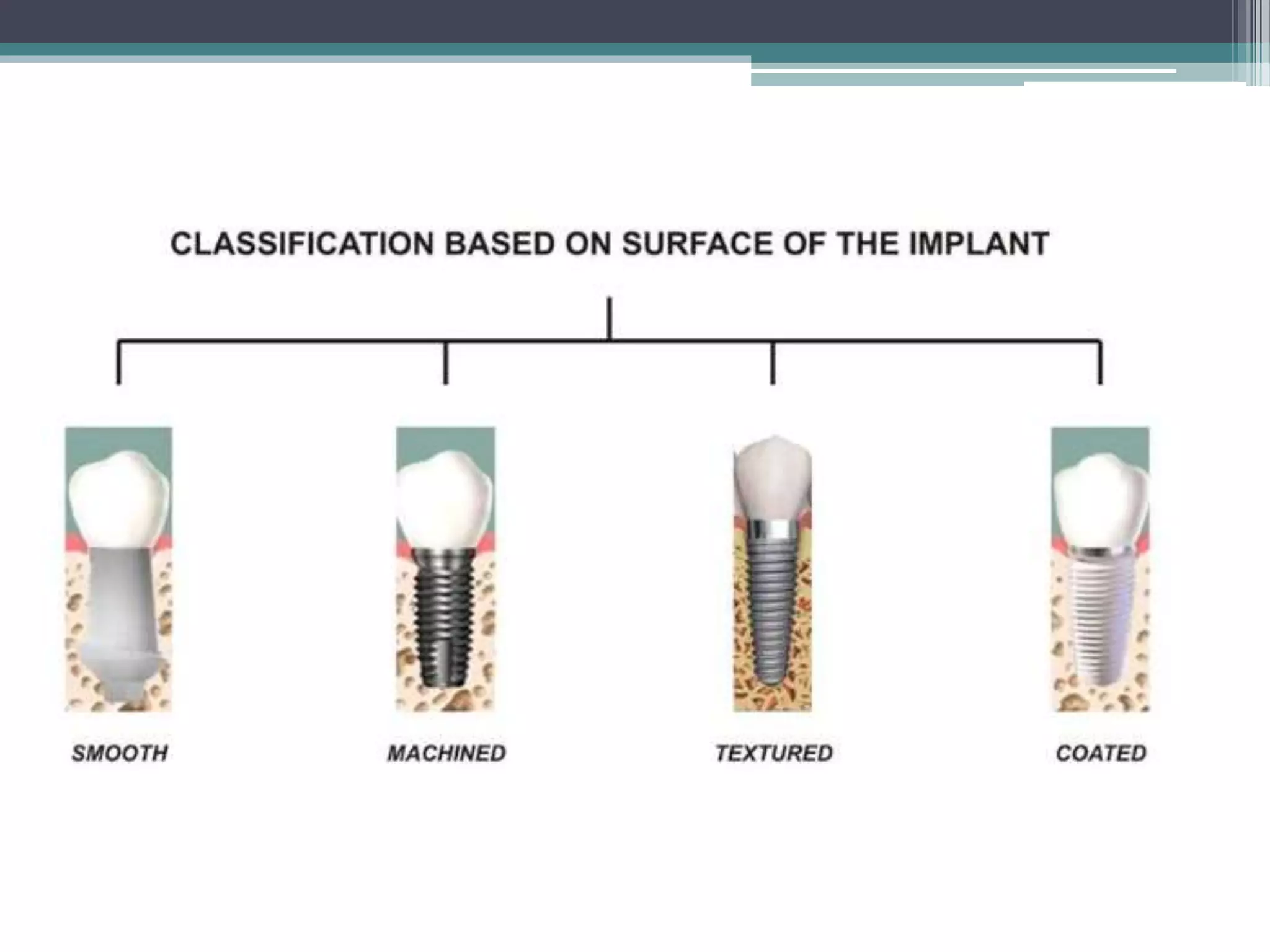 Classification of dental implant | PPTX