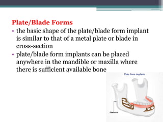 Classification of dental implant | PPTX | Dental Health | Diseases and ...