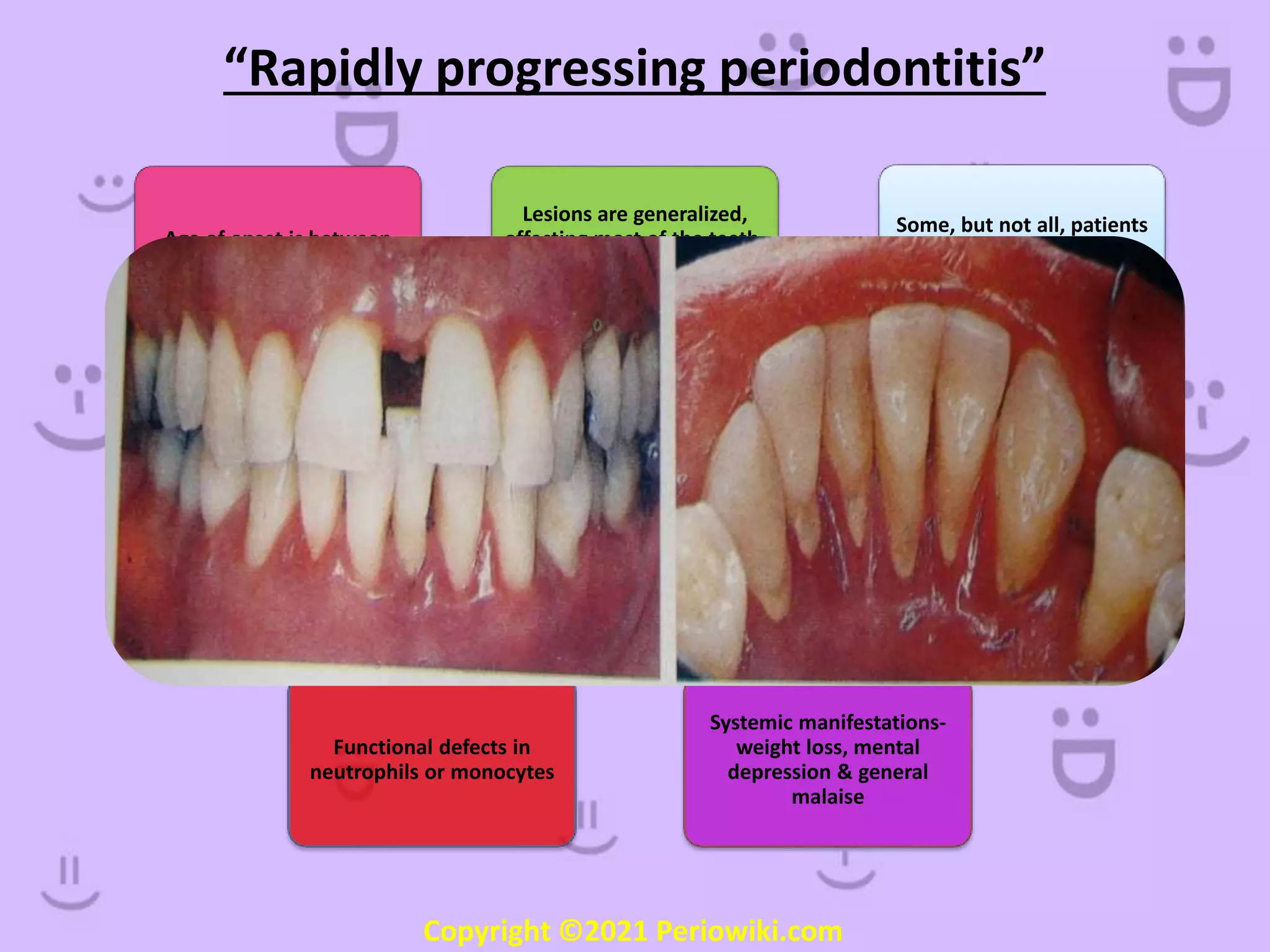 Classification of diseases and conditions affecting the periodontium | PPTX