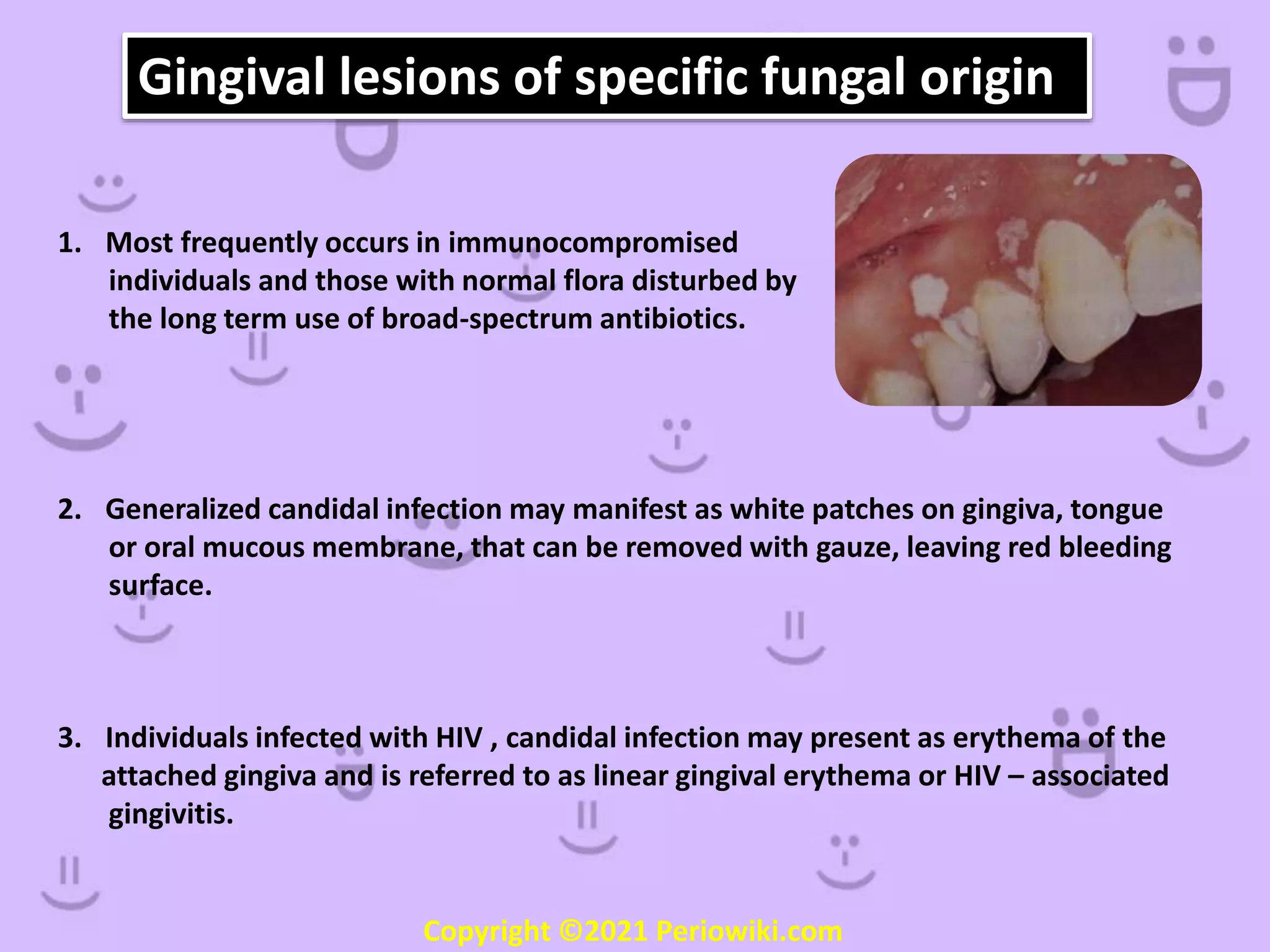 Classification of diseases and conditions affecting the periodontium | PPTX
