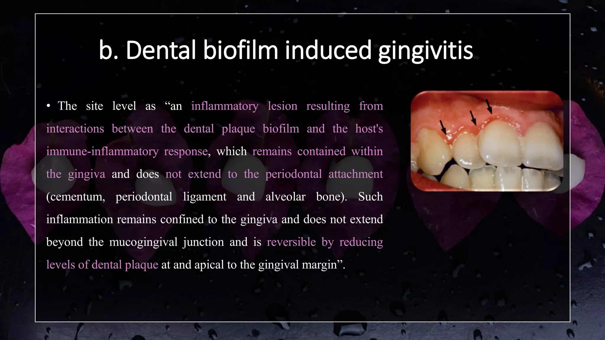 Classification of Diseases & Conditions Affecting the Periodontium.pdf