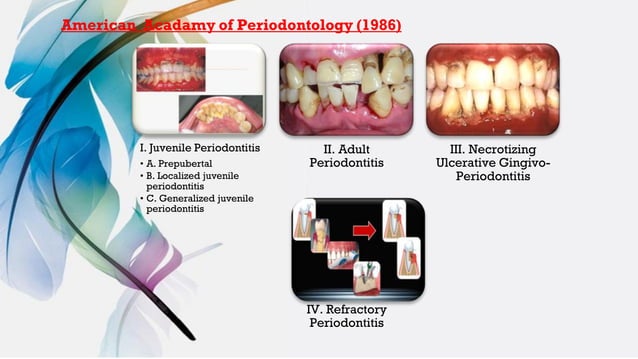 Classification of periodontal diseases | PDF