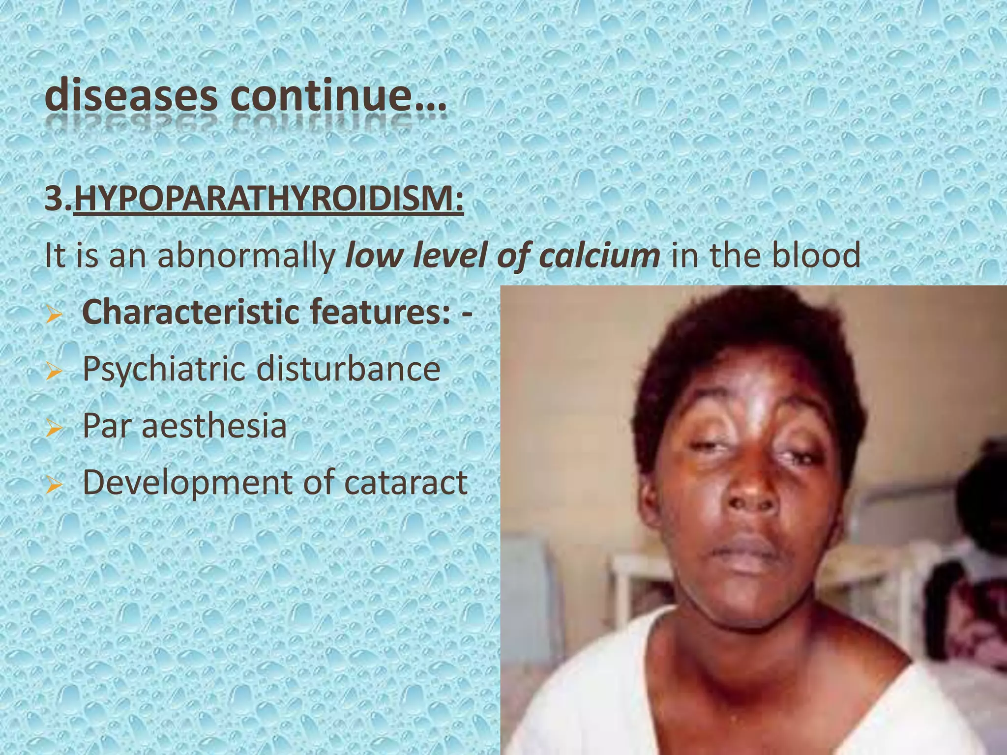classification of endocrine glands and there function.pptx | Endocrine and Metabolic Diseases ...