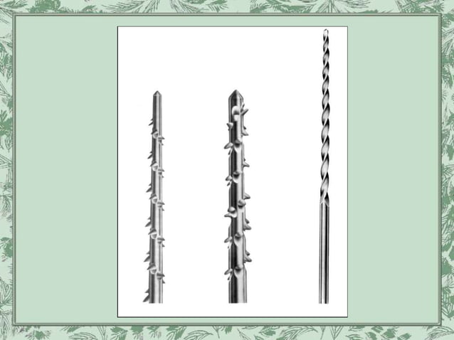CLASSIFICATION OF ENDO INSTRUMENTS | PPT