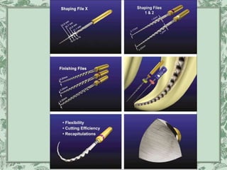 CLASSIFICATION OF ENDO INSTRUMENTS | PPT