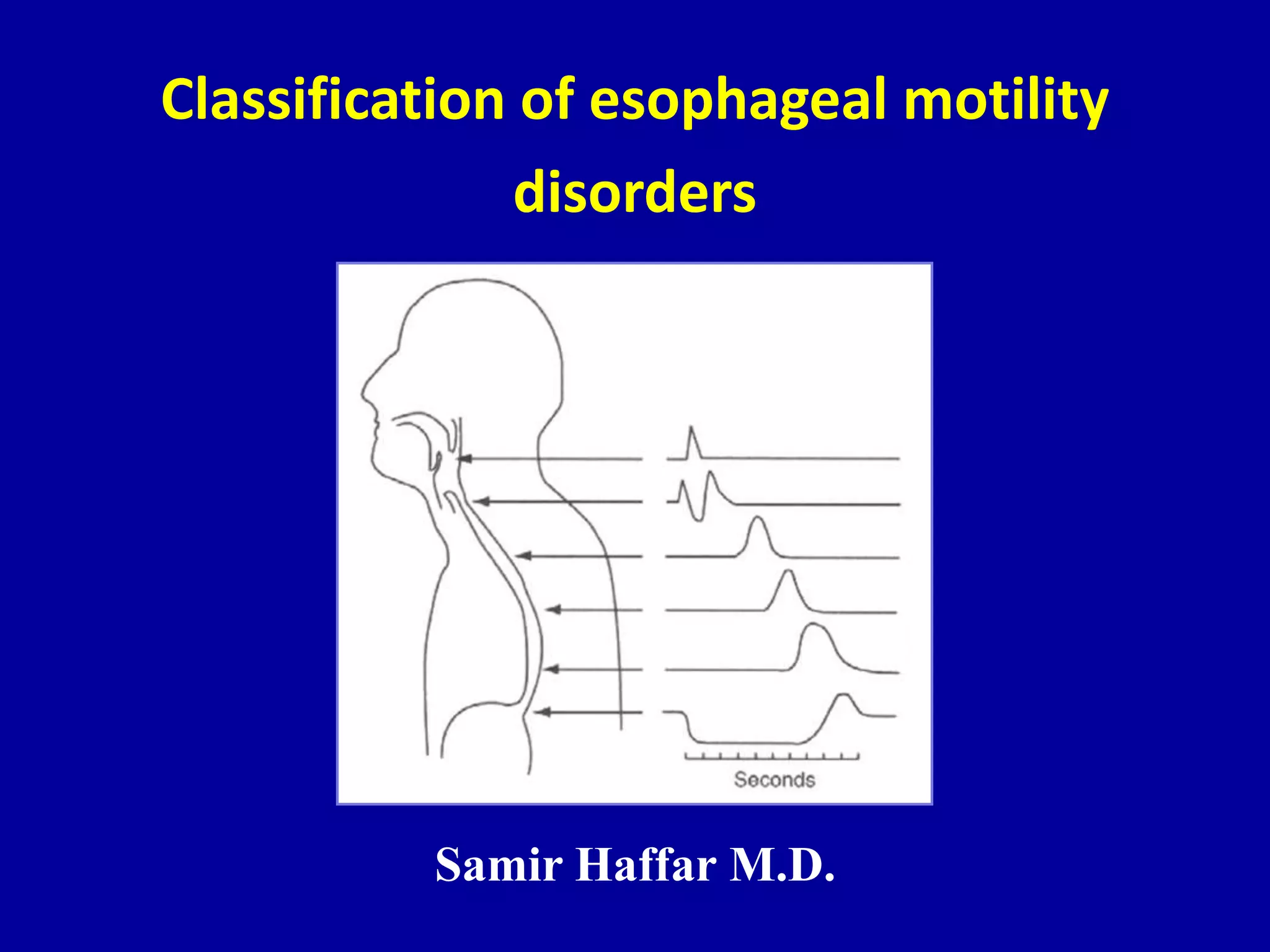 Classification of esophageal motility disorders | PPTX