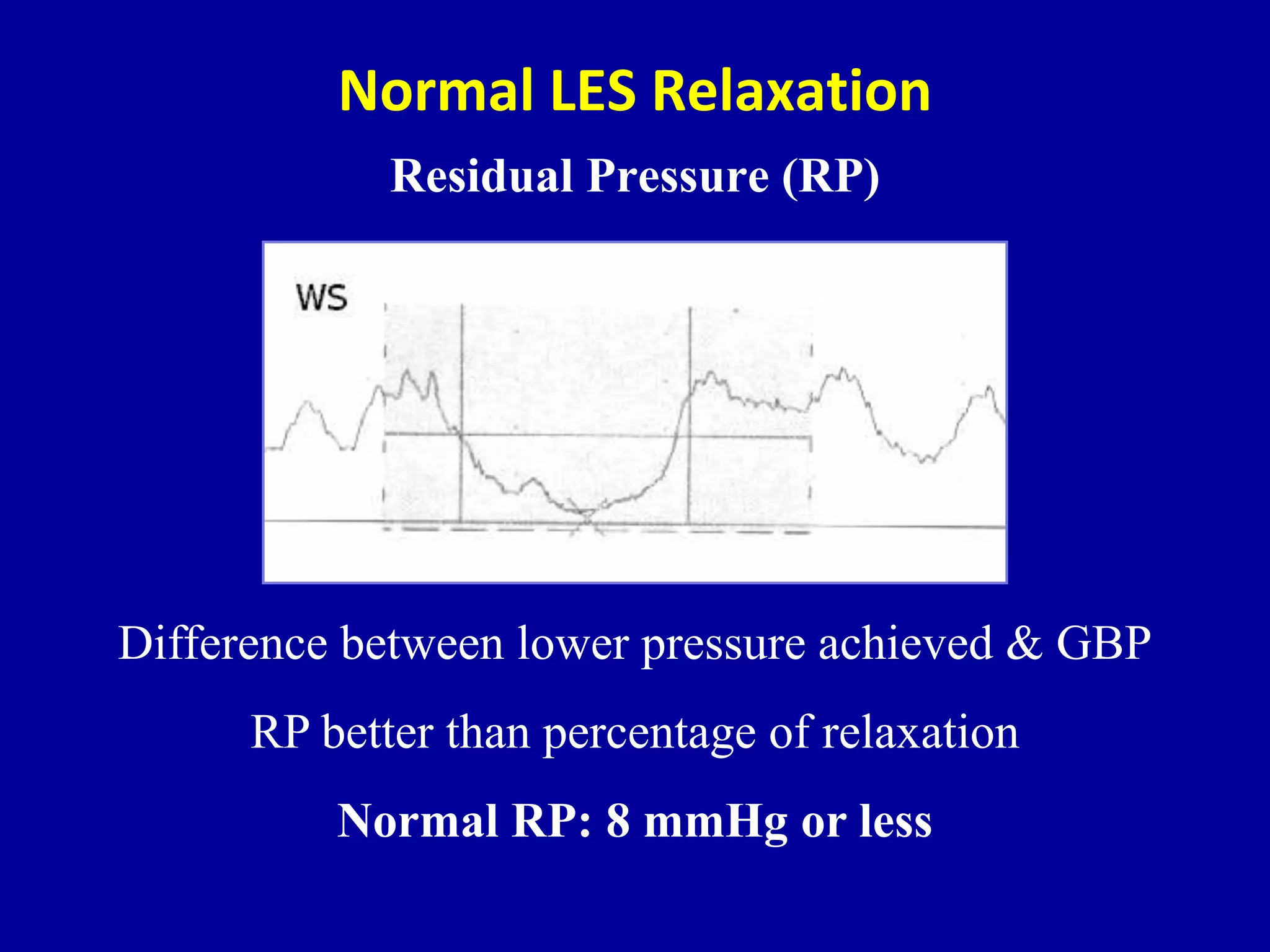 Classification of esophageal motility disorders | PPTX
