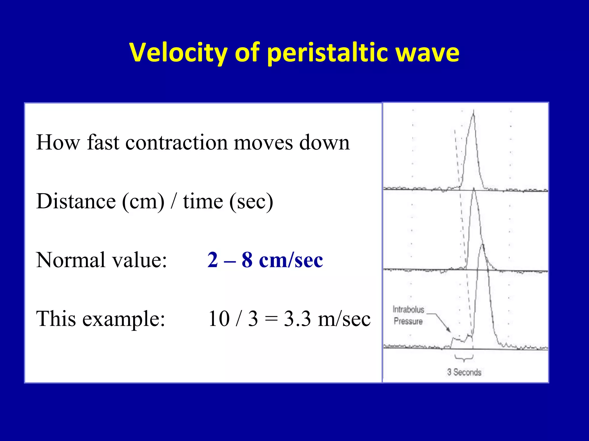 Classification of esophageal motility disorders | PPTX