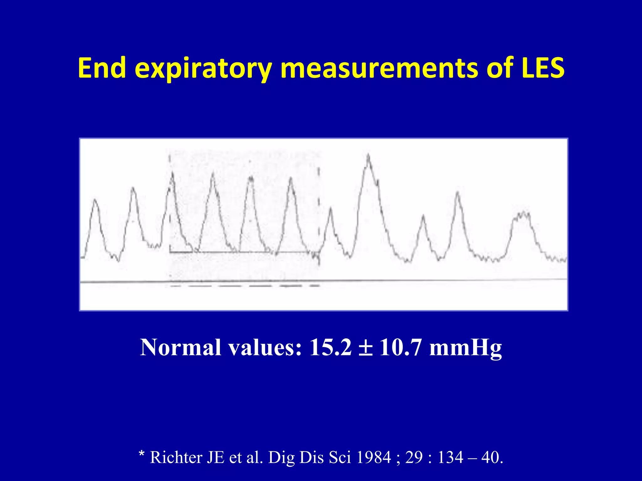 Classification of esophageal motility disorders | PPTX