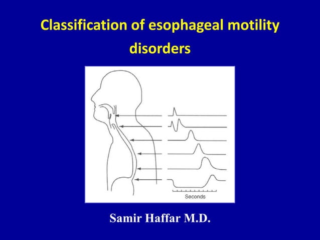 Classification of esophageal motility disorders | PPTX | Digestive ...