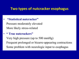 Diffuse Esophageal Spasm Vs Nutcracker Esophagus