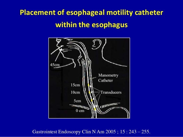 Classification of esophageal motility disorders