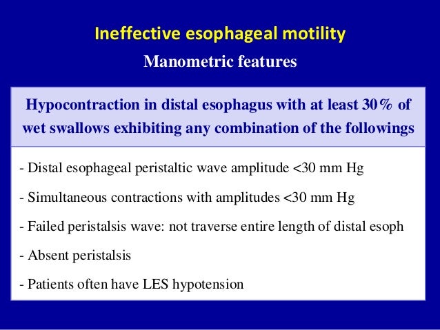 Classification of esophageal motility disorders
