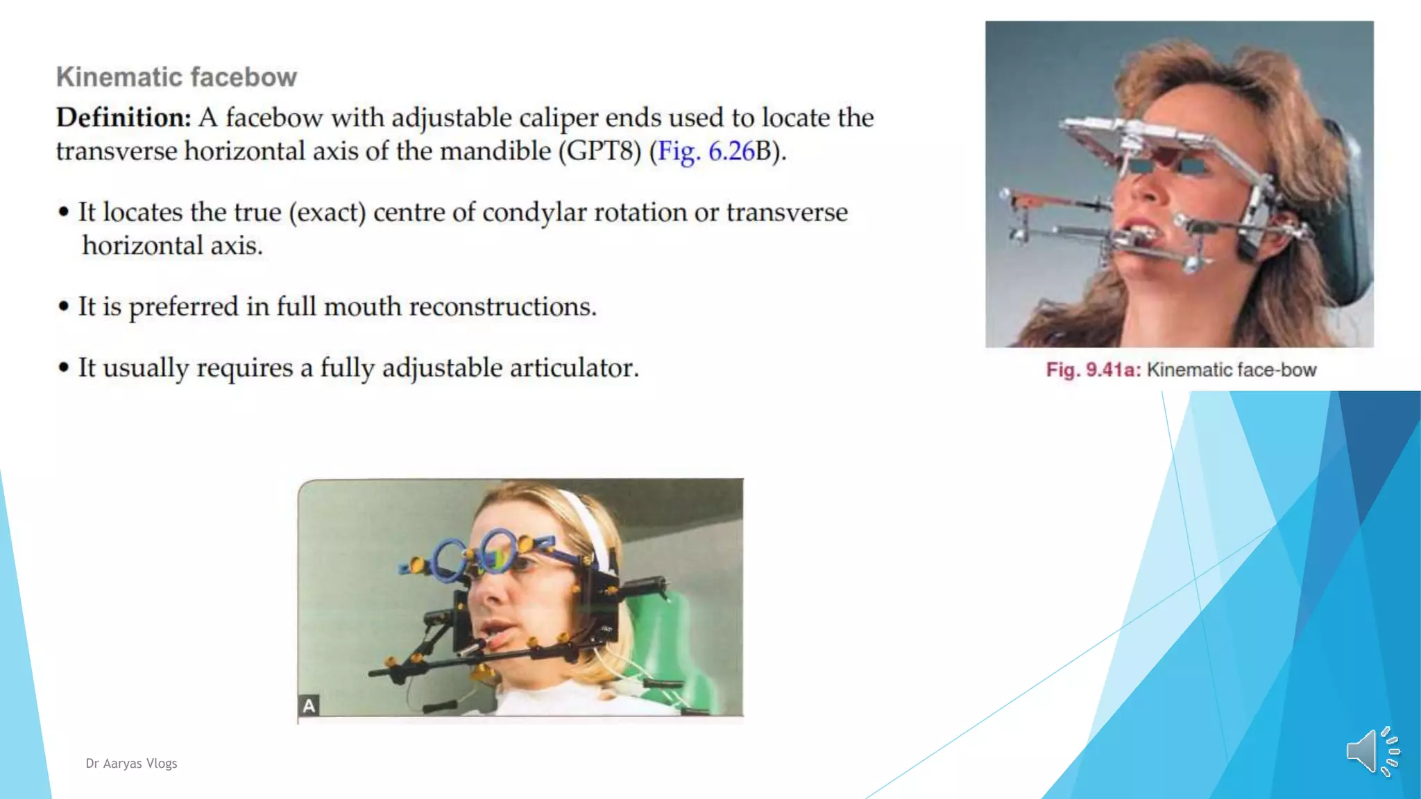 Classification of facebow | PPTX