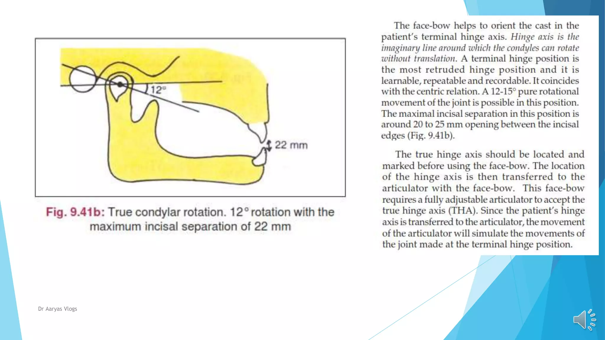 Classification of facebow | PPTX