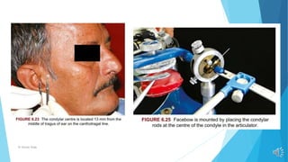 Classification of facebow | PPTX