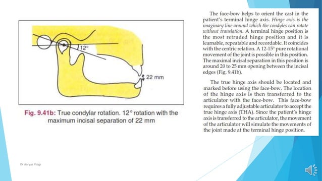 Classification of facebow | PPTX