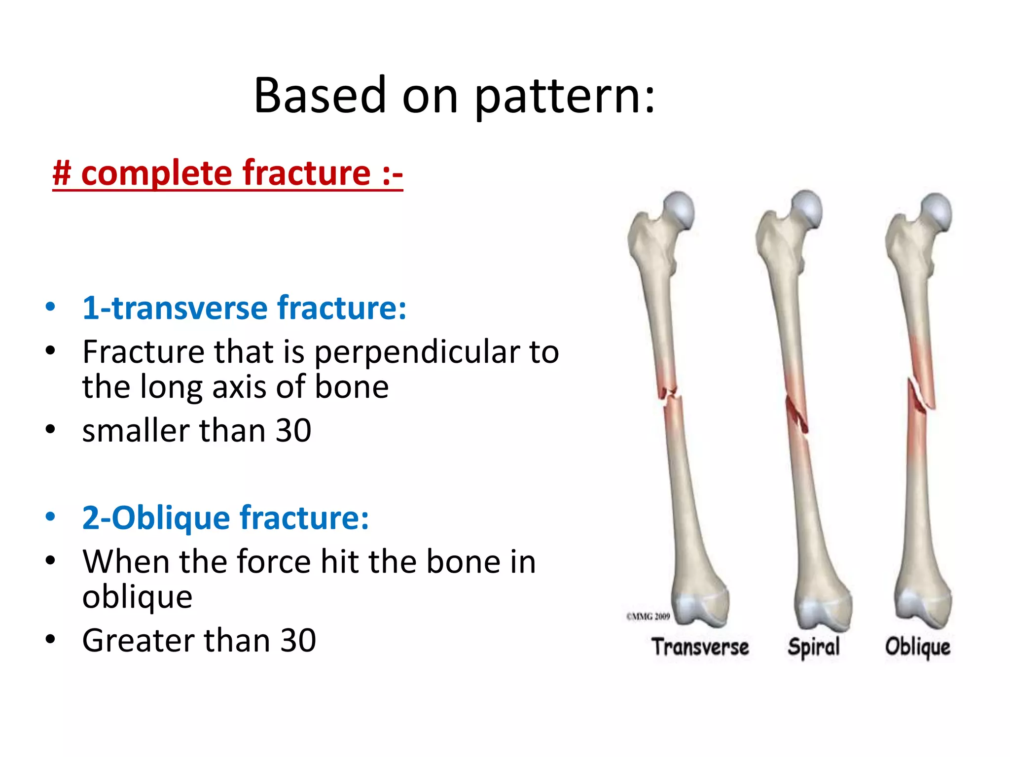 Classification of fracture | PPTX
