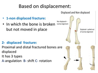 Classification of fracture | PPT