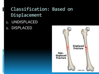 Classification of fractures-2.pptx