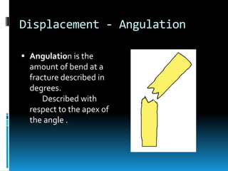 Classification of fractures-2.pptx