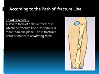 Classification of fractures-2.pptx