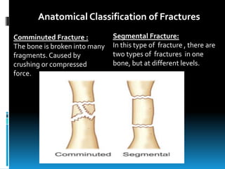 Classification of fractures-2.pptx