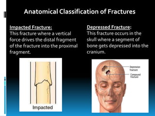 Classification of fractures-2.pptx