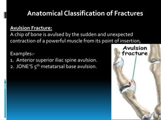 Classification of fractures-2.pptx