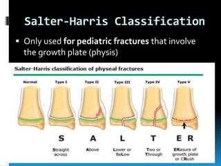Classification of fractures-2.pptx
