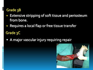 Classification of fractures-2.pptx