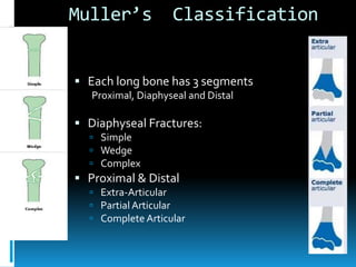 Classification of fractures-2.pptx