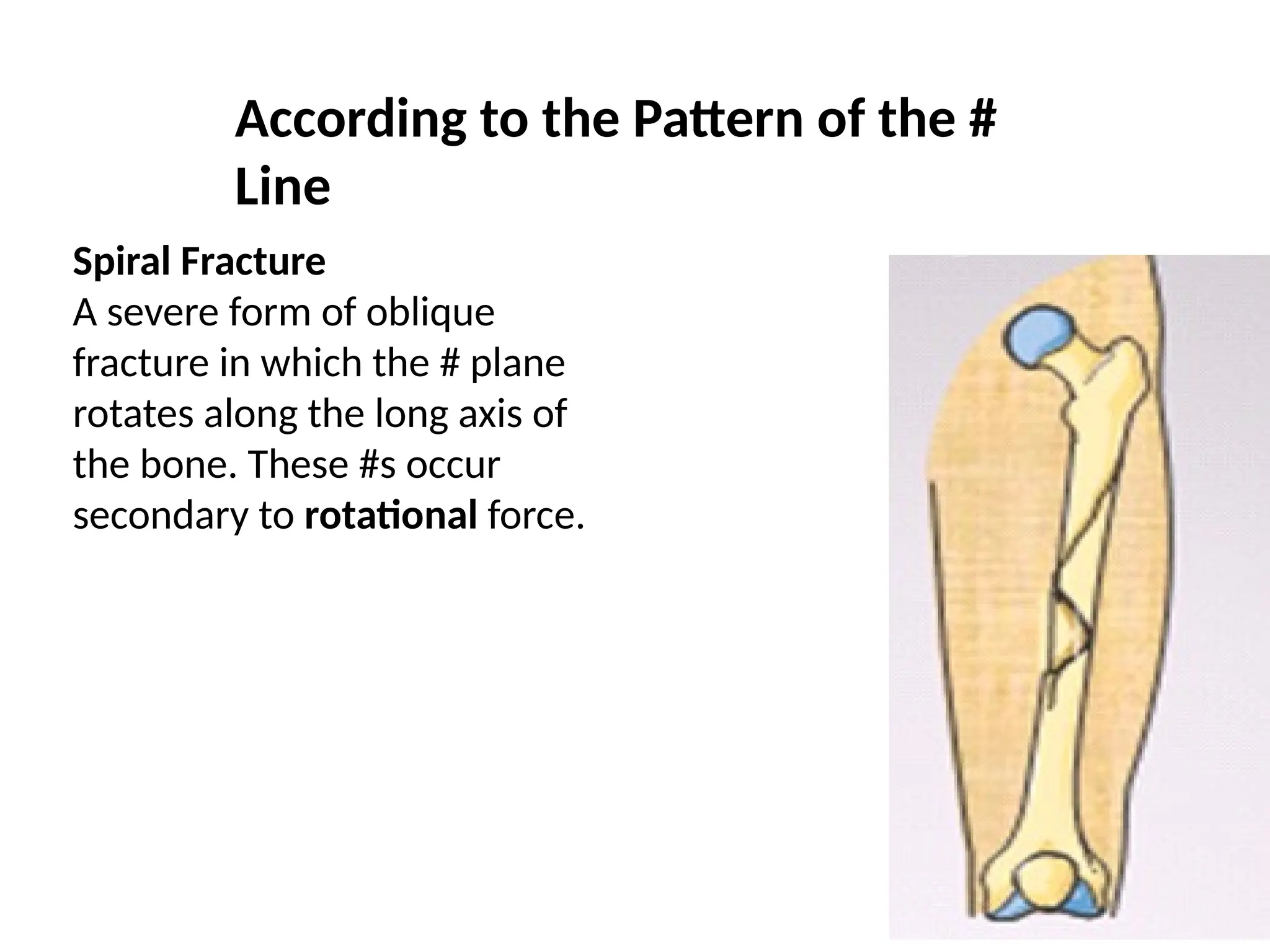 Classification of fractures and fracture healing.pptx