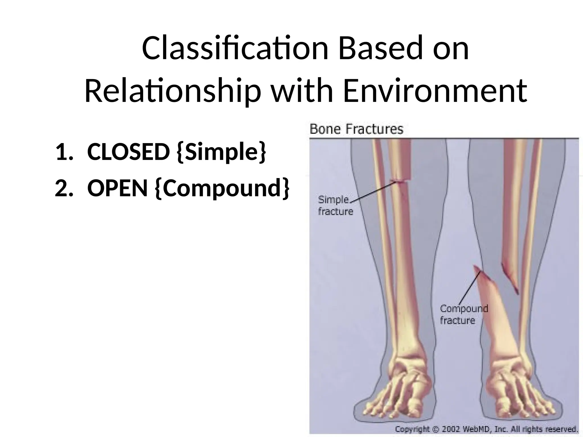 Classification of fractures and fracture healing.pptx