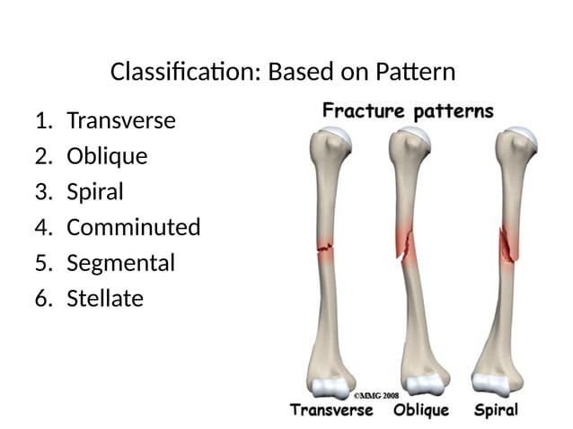 Classification of fractures and fracture healing.pptx