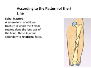 Classification of fractures and fracture healing.pptx