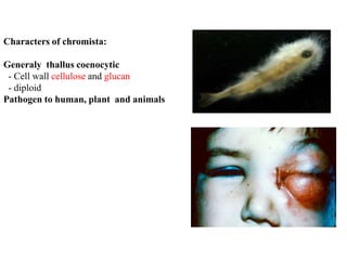 Classification of fungi | PPT
